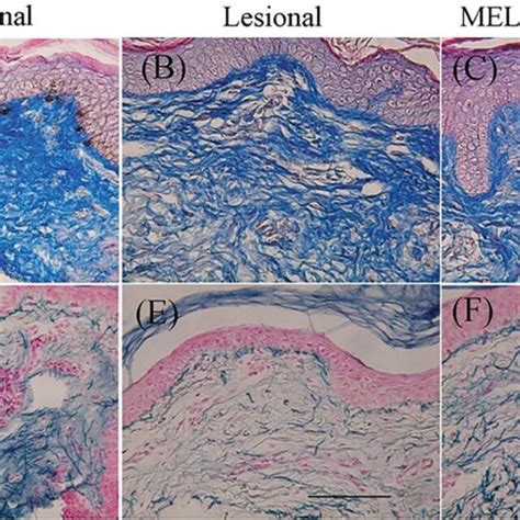 Azan Staining Revealed Well Developed Collagen Fibers Coll In The
