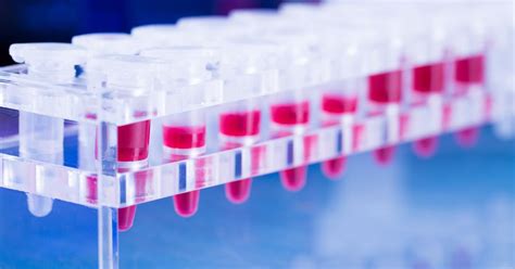 Exai Bio Commercializing Noncoding Rna Method For Liquid Biopsy Applications Genomeweb