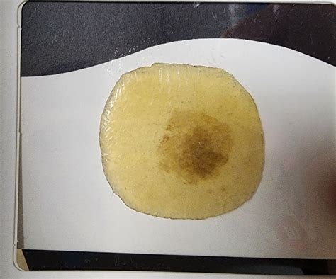 더쿠 흑자 리팟레이저 받은 후기 쌩피부 사진 약간 적나라함 주의