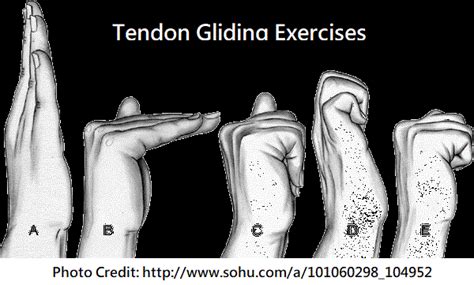 Tendon Gliding Exercises Rehab For A Better Life