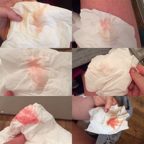 Implantation Bleeding TMI PHOTOS Netmums Chat