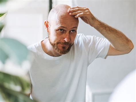 Hair Follicles Can Now Be Grown In Labs What This Means For Hair Loss