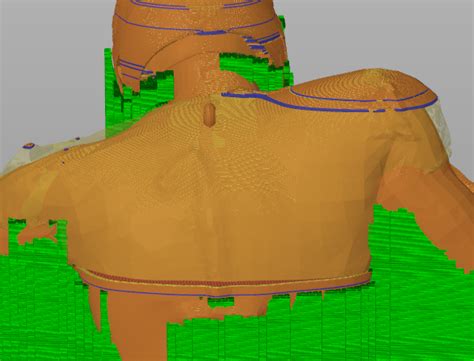 Generating Problem With My Model Prusaslicer Prusa3d Forum