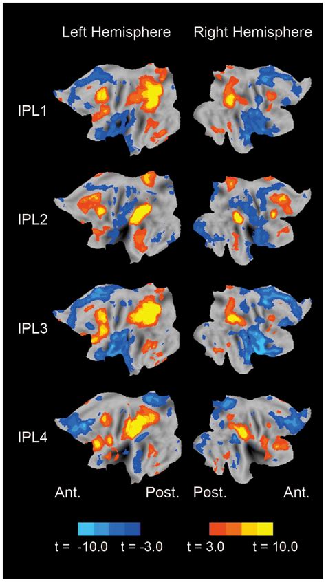 Whole Brain Connectivity Maps Based On Resting State Data The Seeds