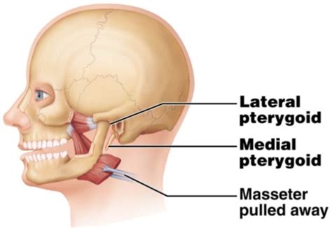 Lecture Infratemporal Region Flashcards Quizlet