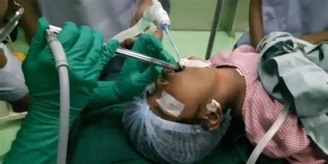 Rigid Esophagoscopy Conditions Dubai Thoracic Surgery Clinic