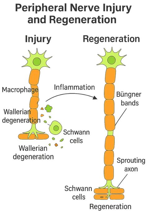Optimizing Peripheral Nerve Regeneration Surgical Techniques Biomolecular And Regenerative