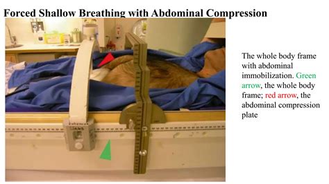 Lung Sbrt Ppt Pptx Lung And Respiratory Health Diseases And Conditions