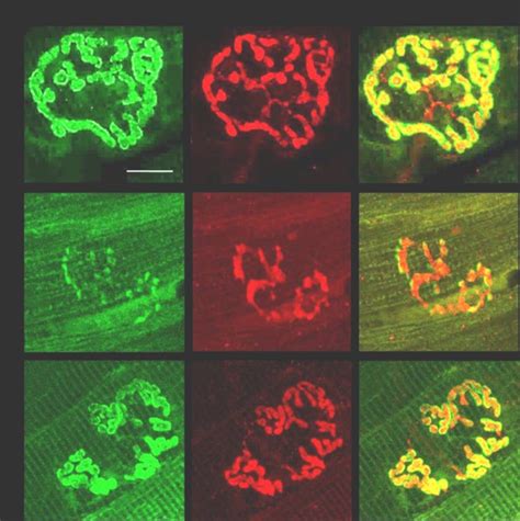 New Publication Salbutamol Modifies The Neuromuscular Junction In A Mouse Model Of Colq