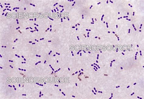 Streptococcus Group A Under A Microscope