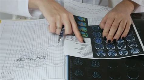 Doctor Examines The X Ray Of The Head In Stock Video Pond
