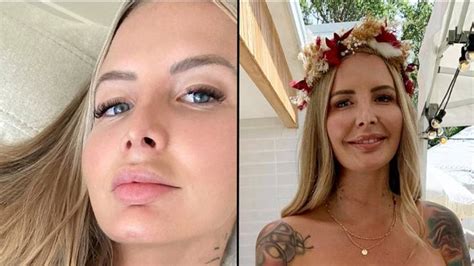 Woman With Two Vaginas Now Uses Onlyfans To Educate Others