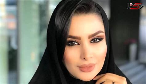 عکس زخم عمیق صورت دنیا جهانبخت بدجوری کتک خورد