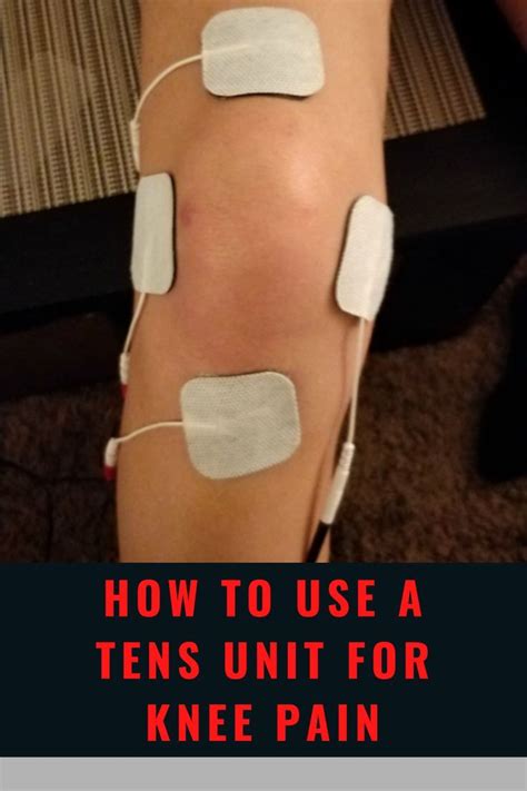 What Are The Best Tens Unit Settings Artofit