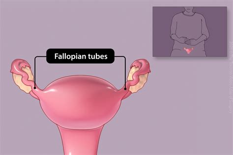 Patient Education Laparotomy Open Surgery The Toronto Video Atlas