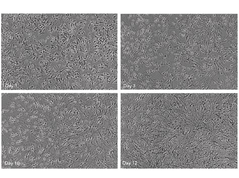4 Top Tips For Culturing Ipsc Derived Gabaergic Neurons