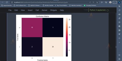 Machine Learning Parkinsons Disease Detection Project TechVidvan