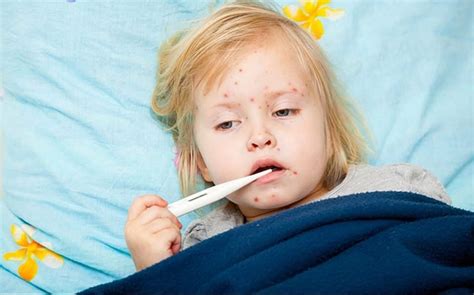 АБТА 🔴Менингококкт халдвар 5 хүртэлх насны хүүхэд голчлон өвддөг Насанд хүрэгчид нянг нь