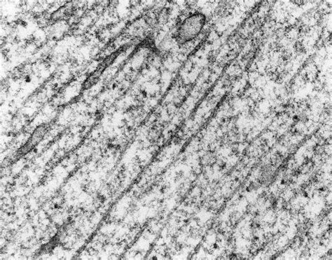 Microtubules In A Dendrite Photograph By Dennis Kunkel Microscopy