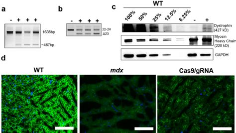 Systemic Delivery Of CRISPR Cas9 By Intravenous Injection Restores