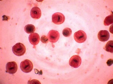 Dead Echinococcus Protoscolices Exposed To H Sabdariffa Calyx Aqueous Download Scientific