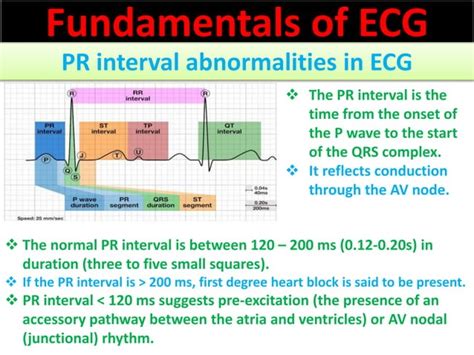 Approach To A Patient With PR Interval Abnormality In ECG PPT