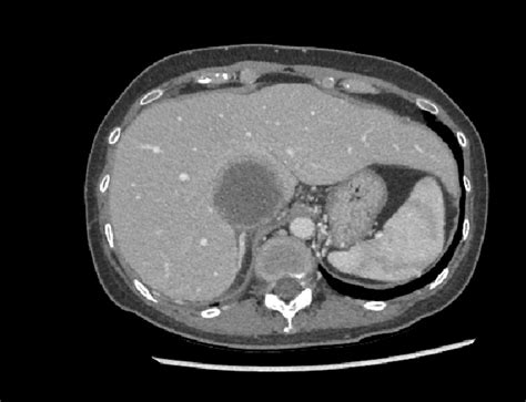 Qimage Scale 16bit Png Image Wrong Qt Forum