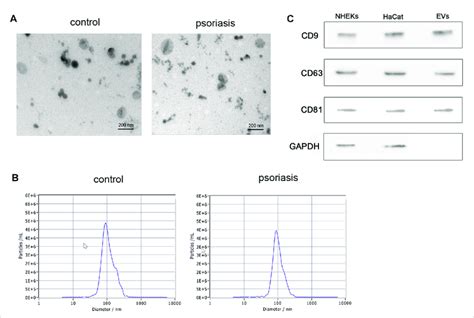 Isolation And Characterization Of Serum Evs A Serum Evs Were