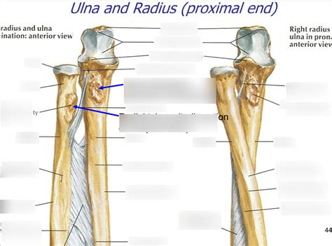 Gross Anatomy Proximal Radius And Ulna Diagram Quizlet