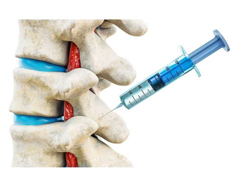 Injection Image Gallery