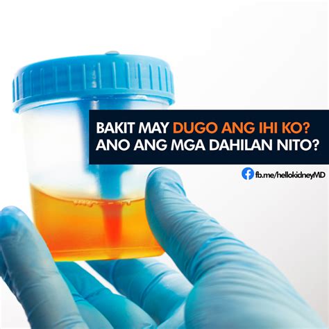 Senyales Ng Uti Sa Lalaki