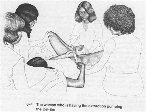 Menstrual Extraction Women S Health In Women S Hands