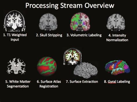 freesurfer pre processing pipeline [17] download scientific diagram