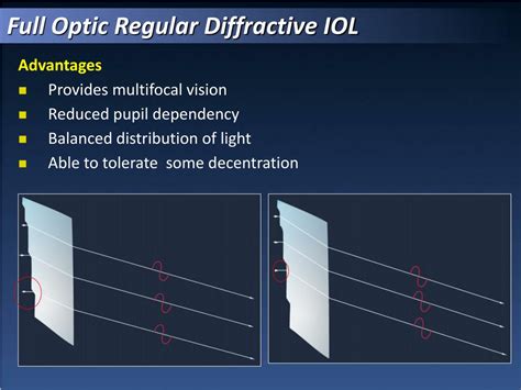 Ppt Eyediff Plus 3 50d Diffractive Multifocal Iol “a New Alternative” Powerpoint Presentation