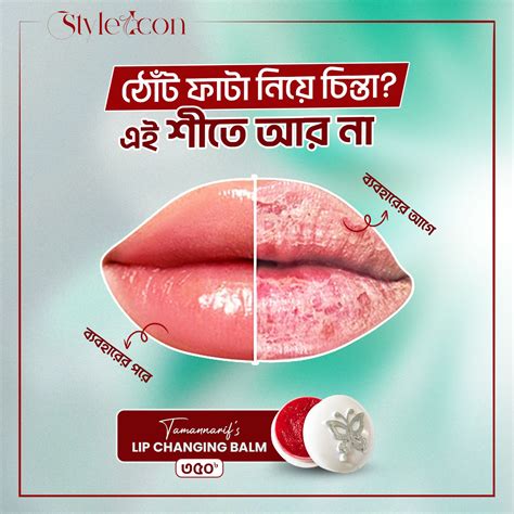Style Icon আসছে শীত ঠোঁট ফাটা নিয়ে চিন্তিত⁉ এই সমস্যা থেকে মুক্তি পেতে দরকার প্রচুর পরিমানে