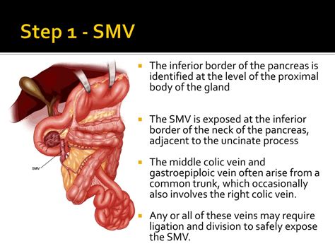 Ppt Carcinoma Pancreas Powerpoint Presentation Free Download Id 471994