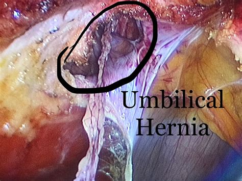 Excel Hospitals Excel Hospitals Drmanish Mehta Etep