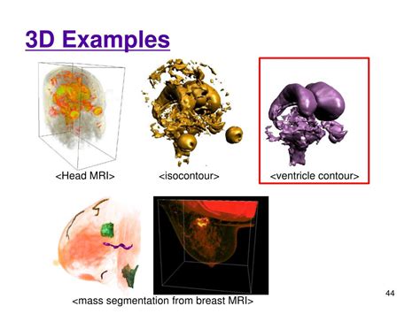 Ppt Lecture 4 Isosurface Extraction Powerpoint Presentation Free Download Id 3341569
