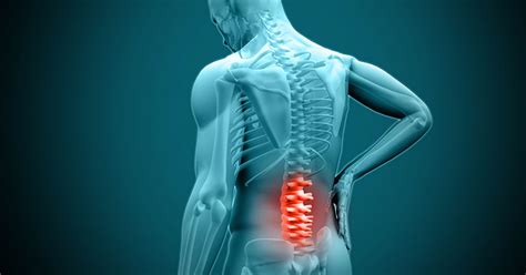 Lumbar Decompression Seattle Wa Brain And Spine Surgery