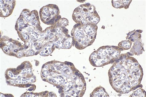 IHCeasy FURIN Ready To Use IHC Kit KHC2173 Proteintech
