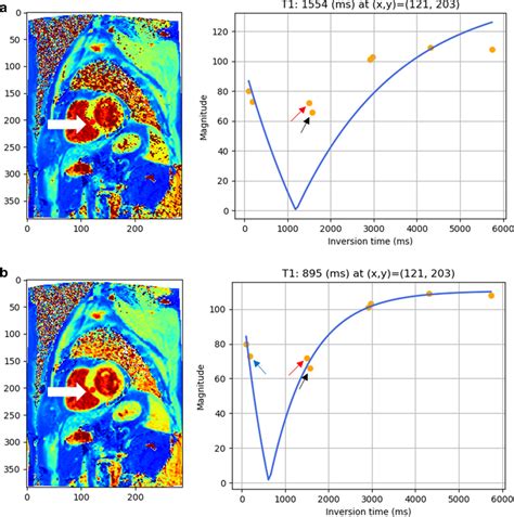 An Example Of Improved Fitting Result After Modification Of The