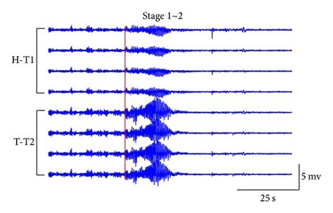 Lfps And The Corresponding Power Spectral Of Seizures In One Example