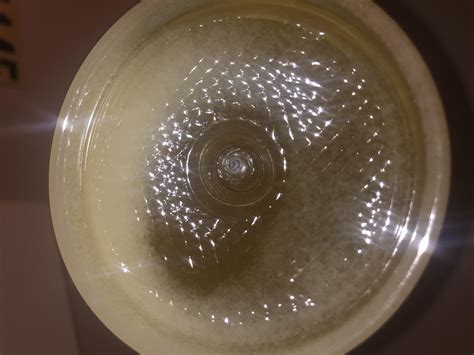 White Mucus In Urine