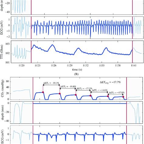 Examples Of Segment Annotation A Rosc Segment And B Non Rosc Pea Download Scientific