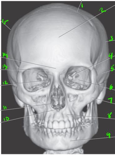 Cranium And Facial Bones Flashcards Quizlet