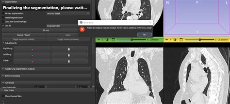 lung ct segmenter now supports lungmask ai for lung and lobe