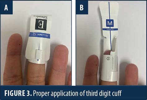 Adapting Advanced Hemodynamic Monitoring To Optimize Surgical Outcomes In Bariatric Surgery