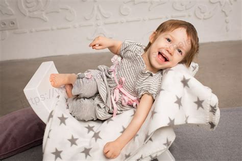 Благодійний фонд Ярослав Лампа фототерапії проти незворотного впливу жовтяниці у