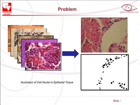 a cells segmentation approach in epithelial tissue using histology