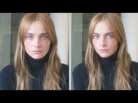 Surgery Short Faced Model Baby Faced Cutie Youtube